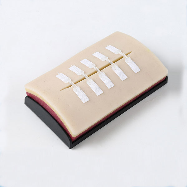 Surgical wound closure for Cesarean section